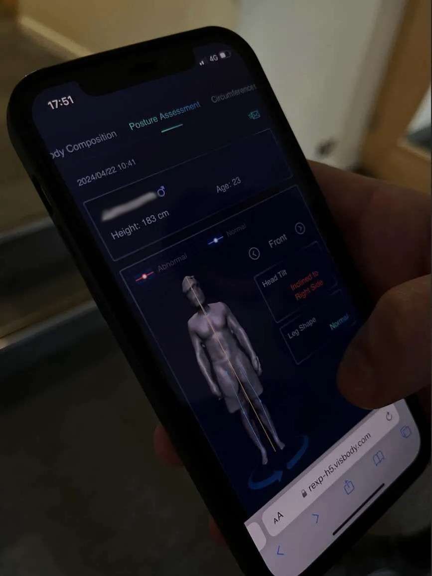Visbody 3D Body scanner | Clitheroe Cryo